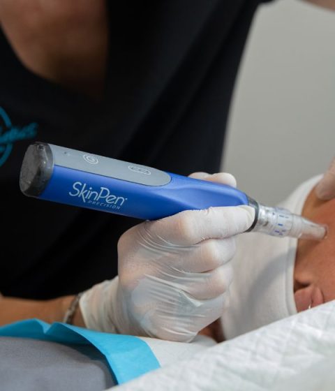 Skin Needling - Precision Aesthetics